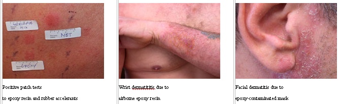 Skin Allergy Research at Wear Earrings Again with Maggie's Creations ...